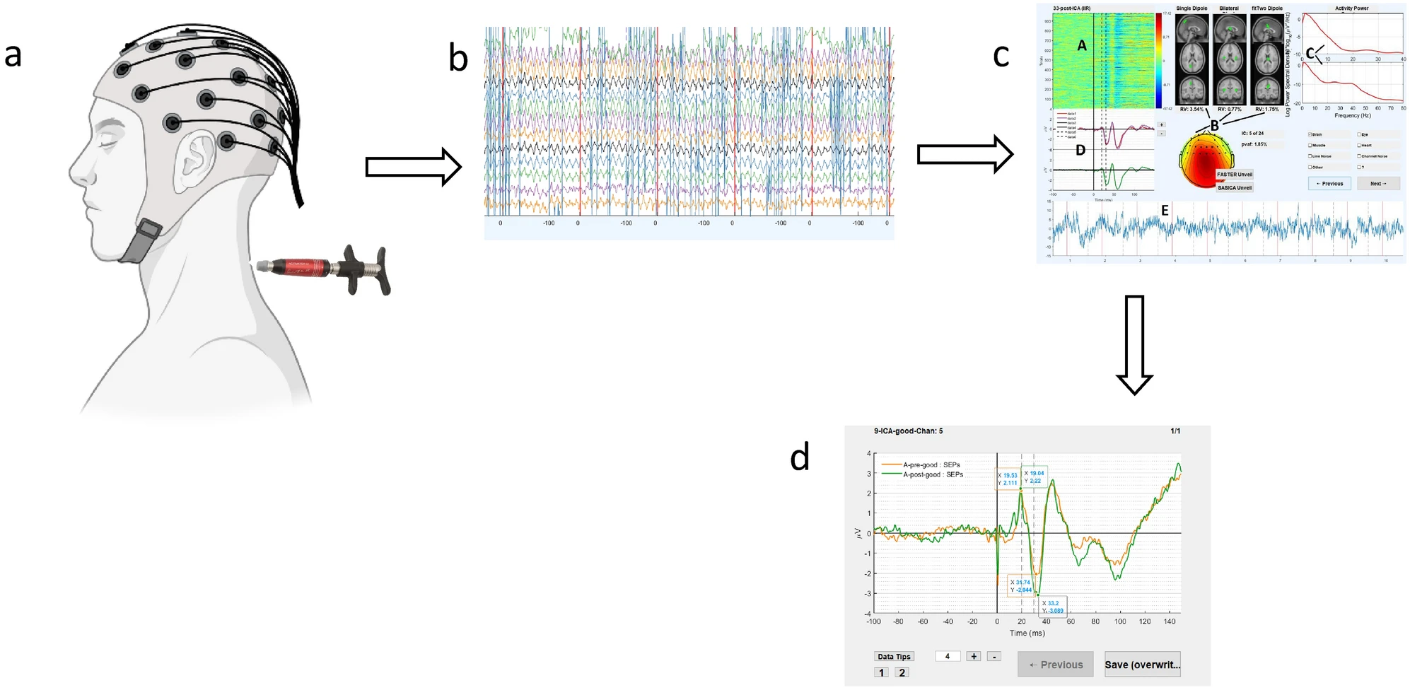 A randomized controlled trial comparing different sites of high ...